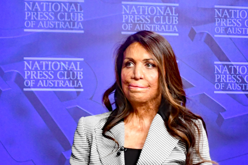 Turia Pitt: How to rewrite your own story | HerCanberra